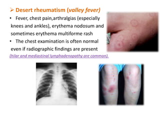 Principles of Fungal Diagnosis and Treatment | PPTX