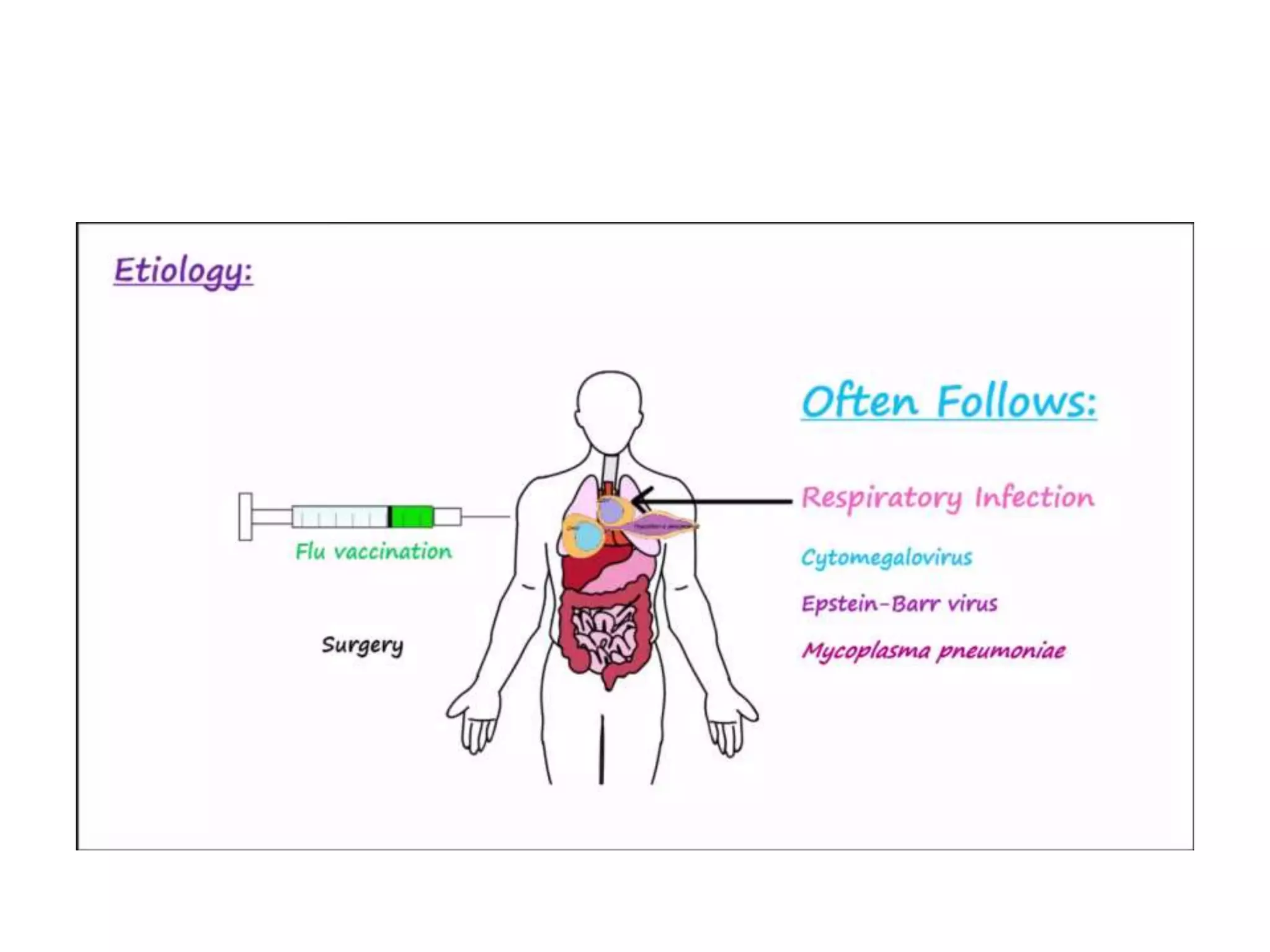 Guillian Barre Syndrome | PPTX