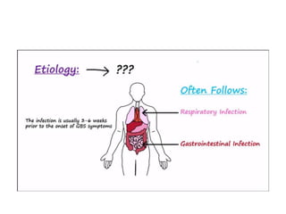 Guillian Barre Syndrome | PPTX
