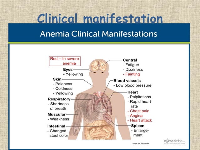 Anemia | PPTX | Blood Disorders | Diseases and Conditions