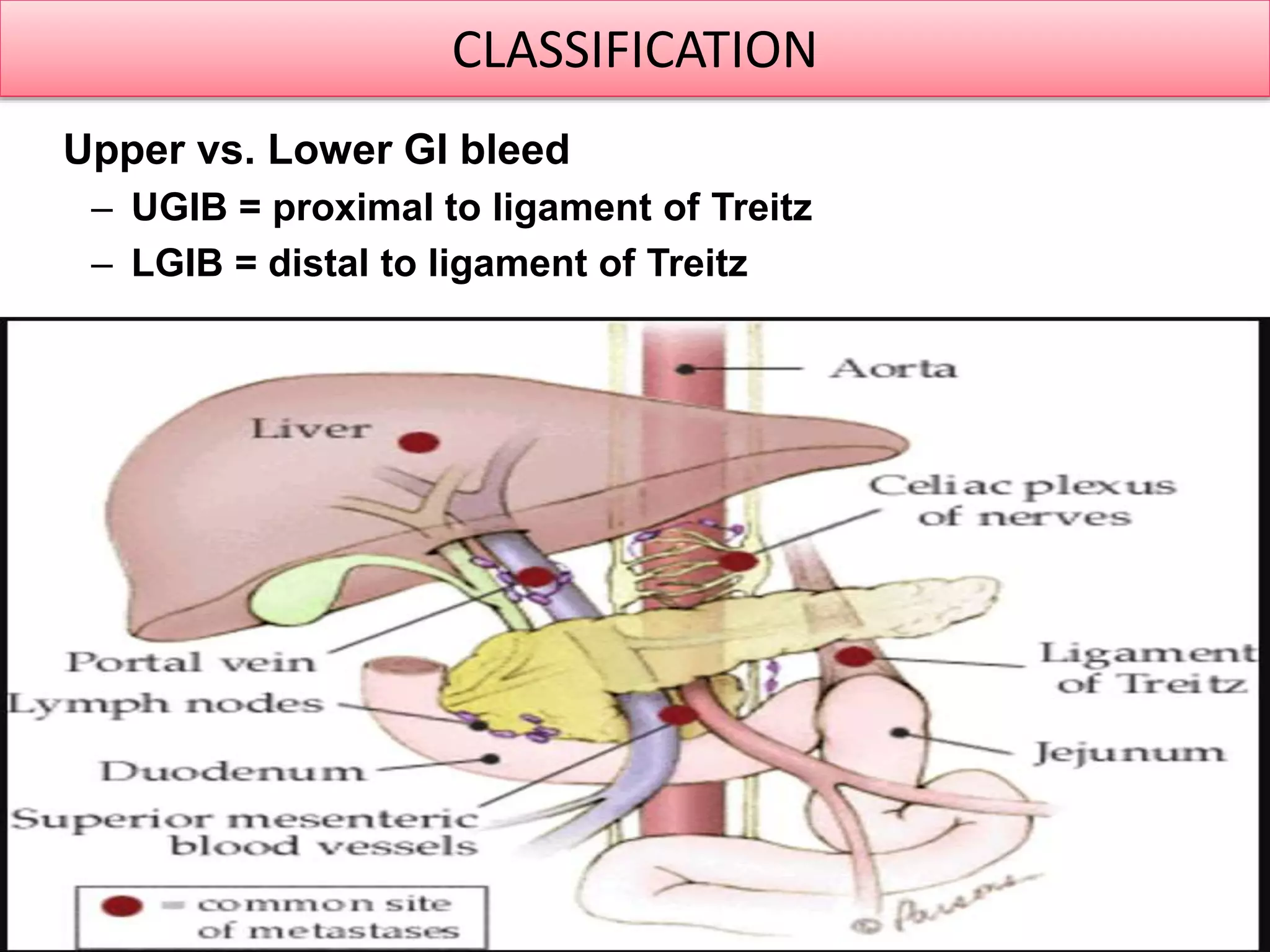 gastrointestinal bleeding ( GI Bleed) | PPTX