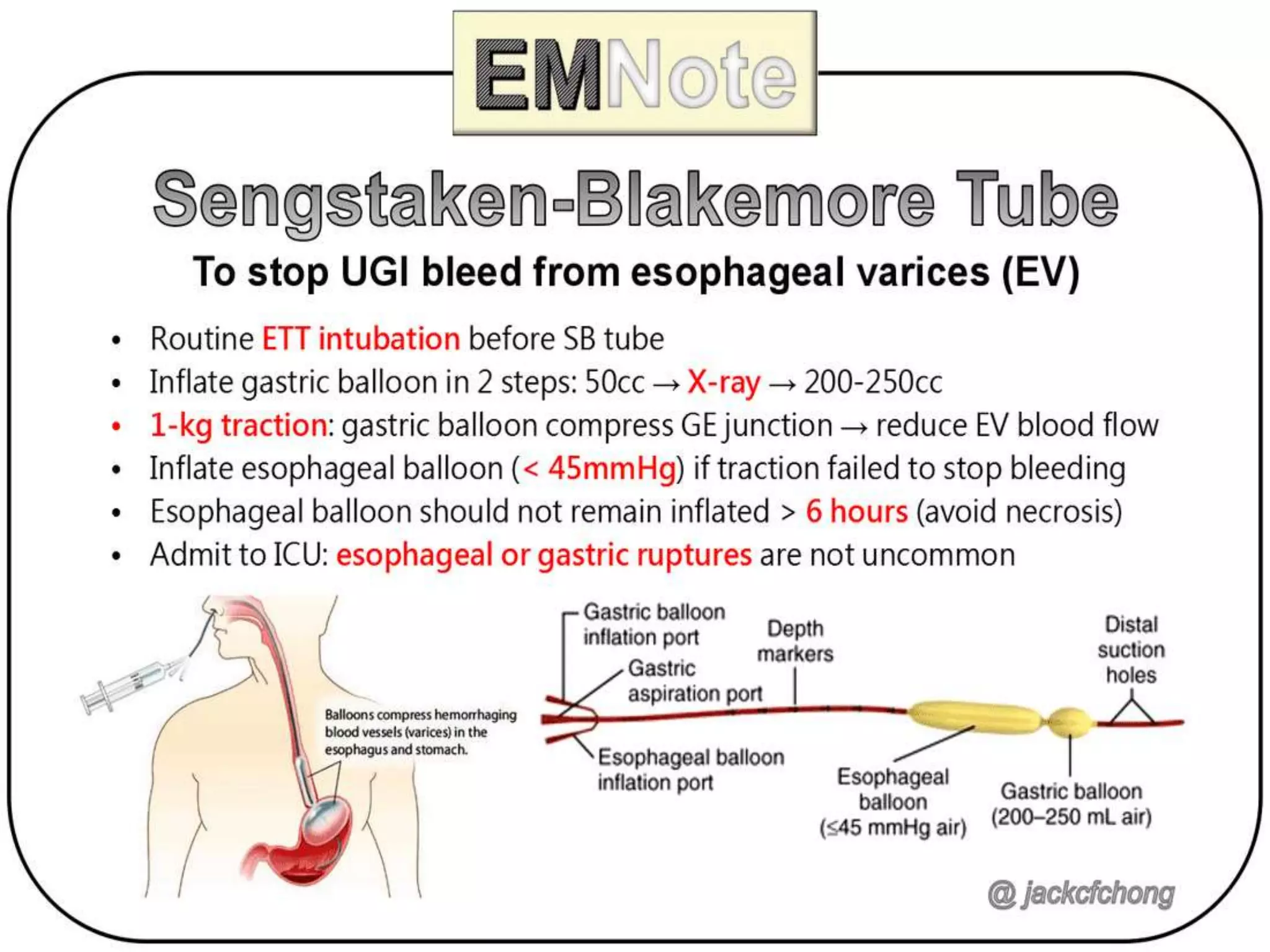 gastrointestinal bleeding ( GI Bleed) | PPTX