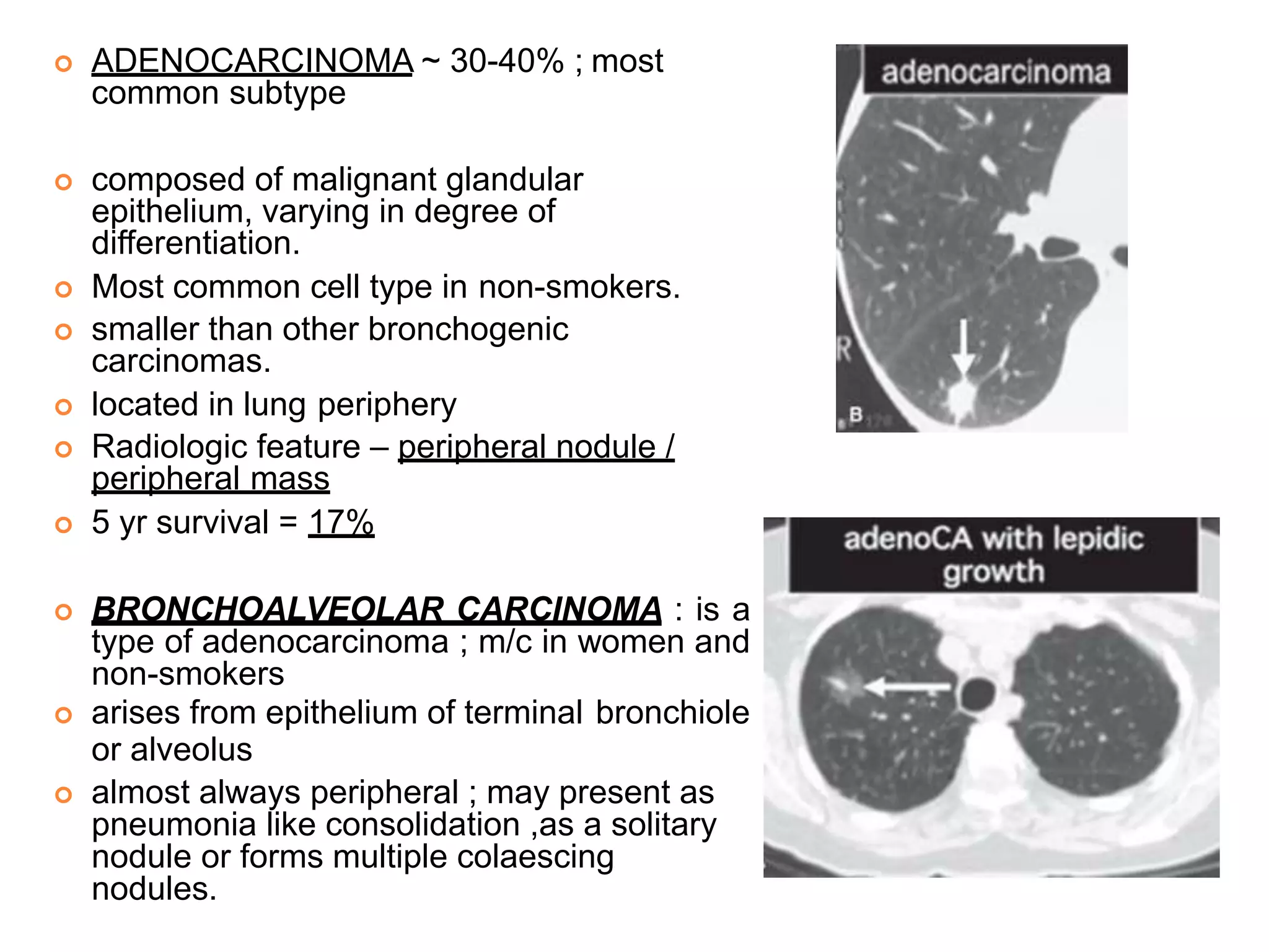 BENIGN AND MALIGNANT LUNG NEOPLASAM MASSES | PPTX