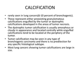 BENIGN AND MALIGNANT LUNG NEOPLASAM MASSES | PPTX