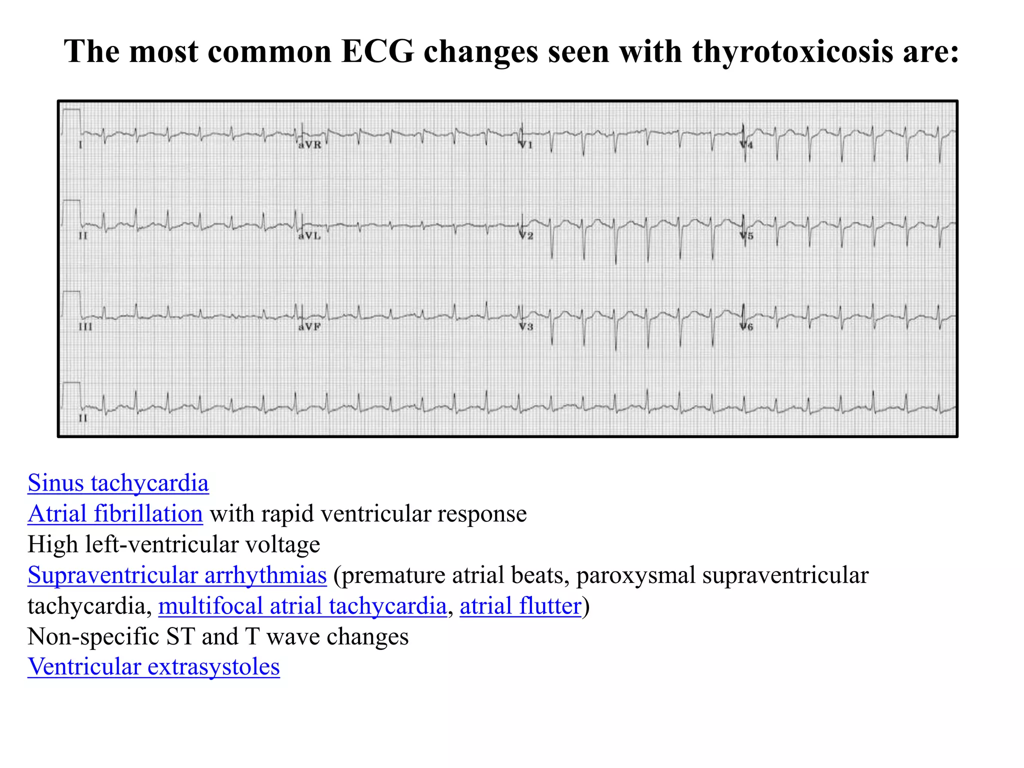 ECG abnormalities in drugs, temperature, electrolyte , metabolic and ...