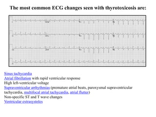 ECG abnormalities in drugs, temperature, electrolyte , metabolic and ...