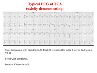ECG abnormalities in drugs, temperature, electrolyte , metabolic and ...
