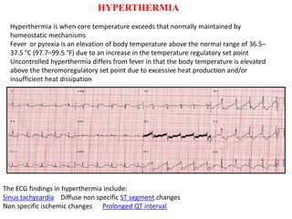 ECG abnormalities in drugs, temperature, electrolyte , metabolic and ...