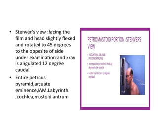 New microsoft office power point presentation | PPTX | Ear, Nose and ...