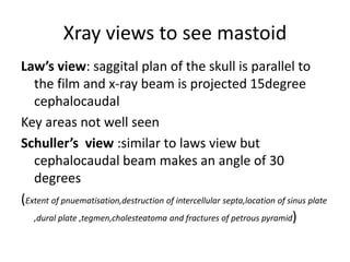 New microsoft office power point presentation | PPTX | Ear, Nose and ...