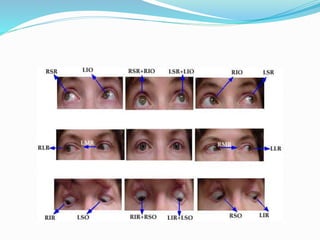 Extraocular muscles | PPTX