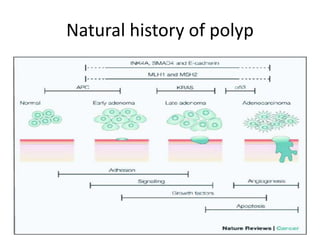 Advanced Endoscopic Imaging in Lower Gastrointestinal Disease: present ...