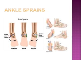 TENDON AND LIGAMENT DISORDERS | PPTX