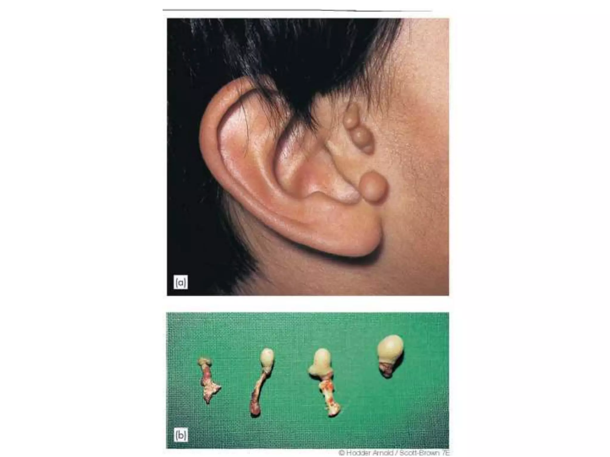 External ear- development | PPT