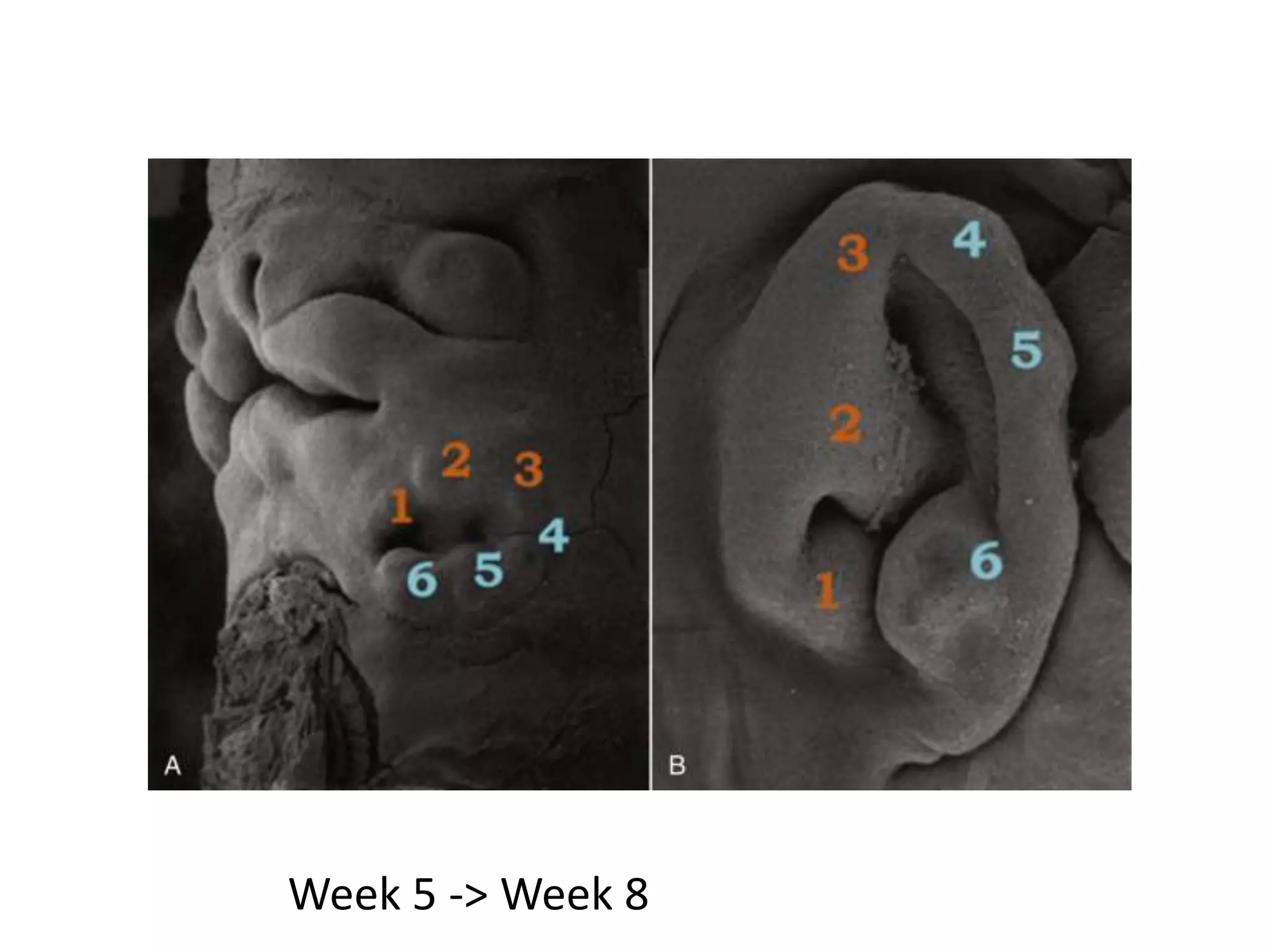 External ear- development | PPT