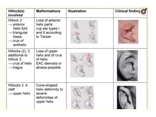 External ear- development | PPT