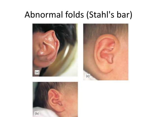 External ear- development | PPT