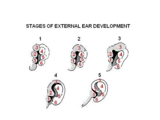 External ear- development | PPT