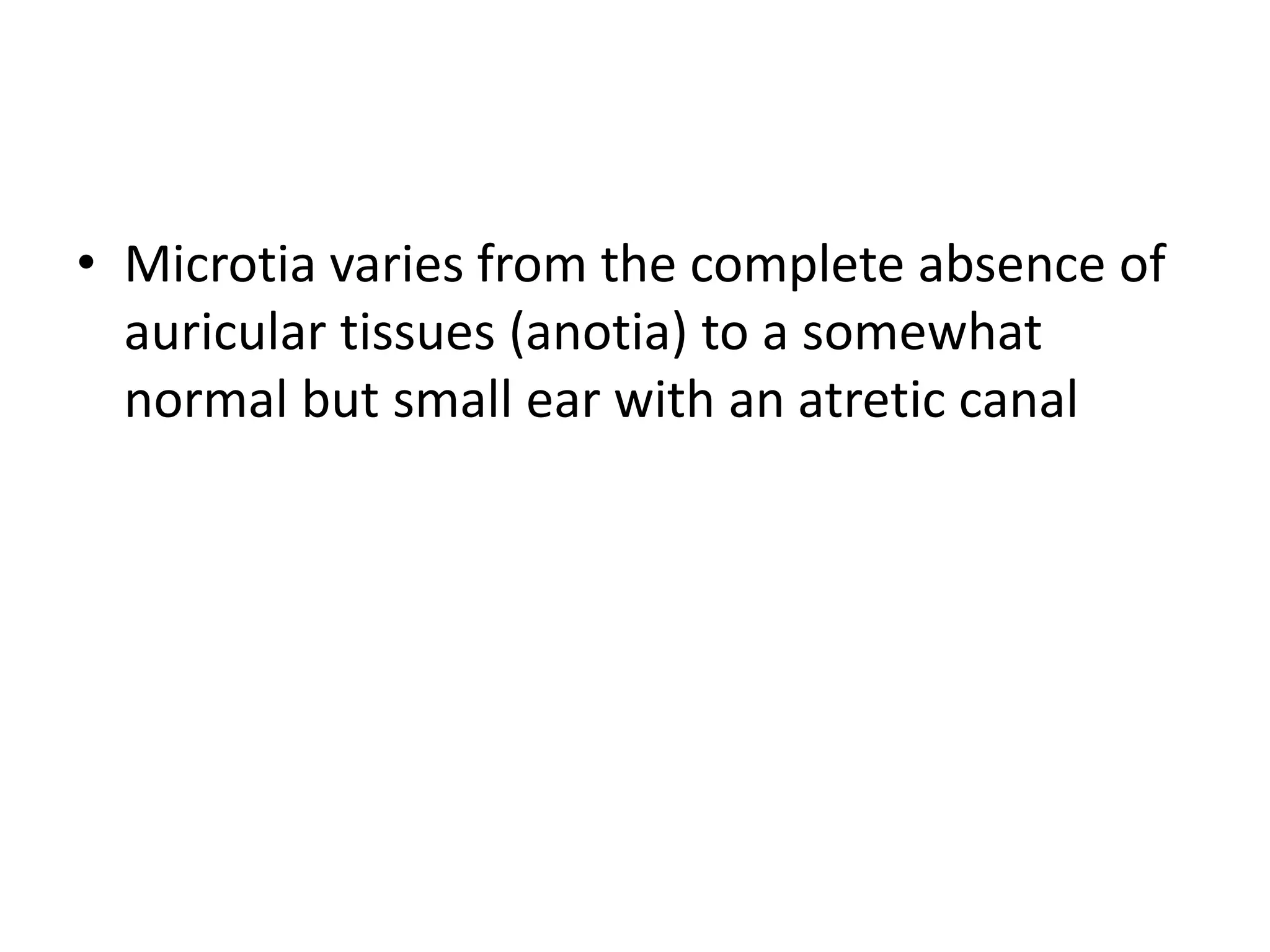 Microtia- diagnosis and management | PPTX