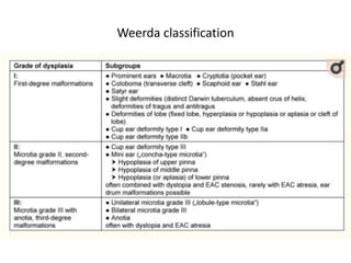 Microtia- diagnosis and management | PPTX