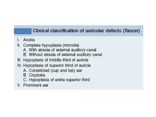 Microtia- diagnosis and management | PPTX