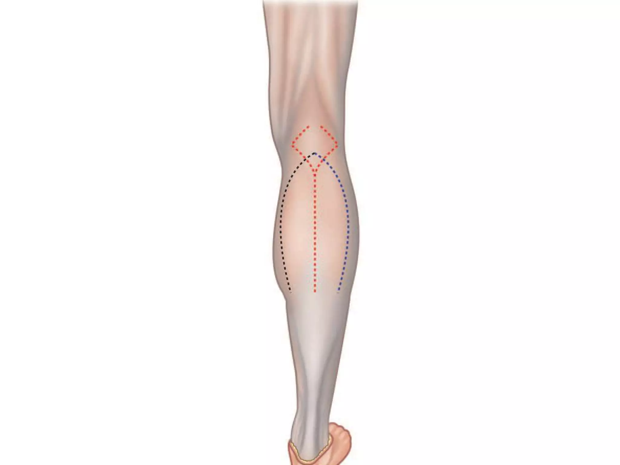 Gastrocnemius and Forehead flap | PPT