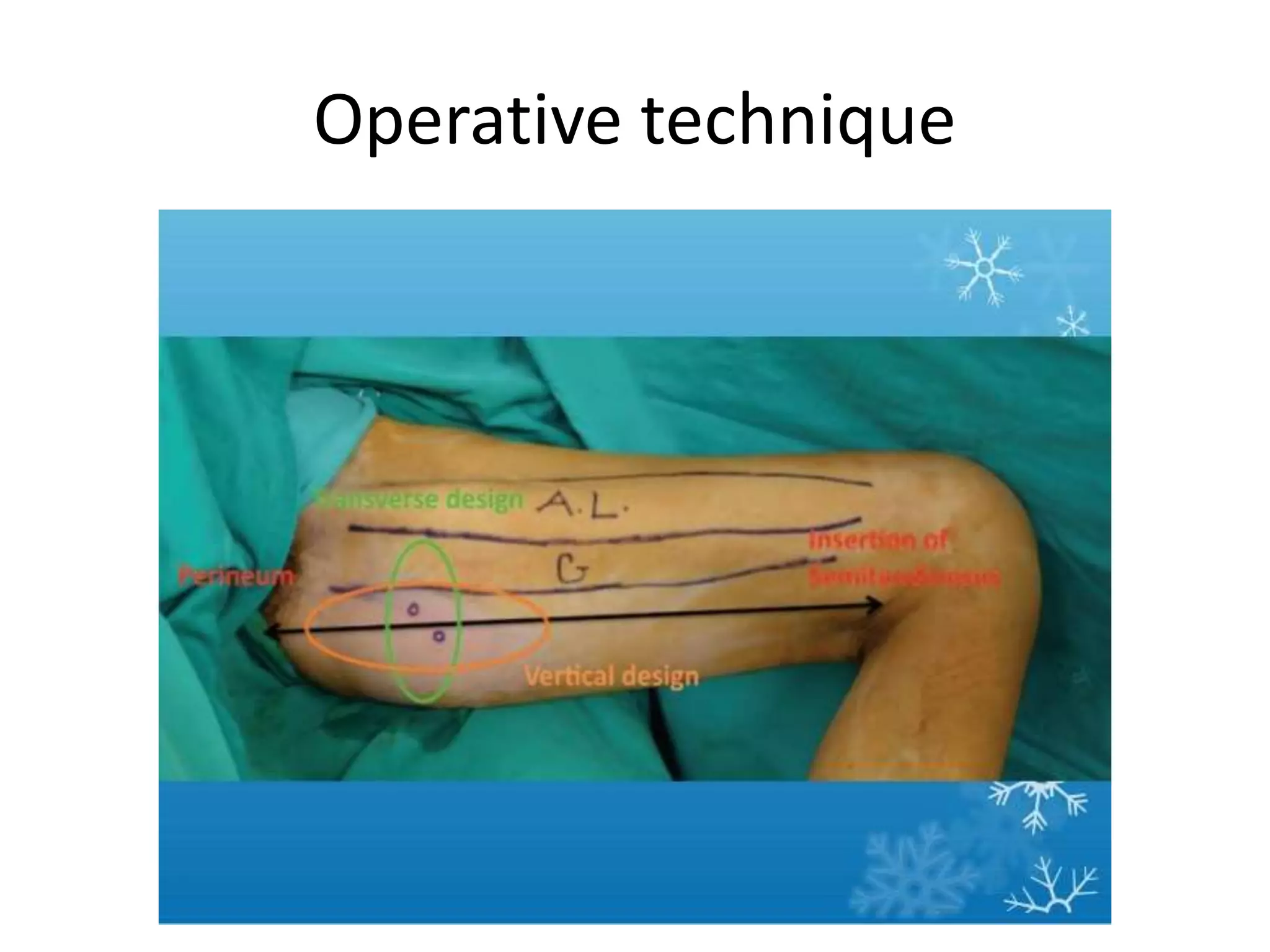 Gracilis and Latissimus Dorsi flap | PPTX | Death, Injury, or Military ...