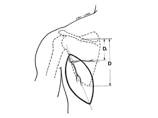 Parascapular and free fibula flaps | PPTX