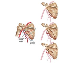 Parascapular and free fibula flaps | PPTX