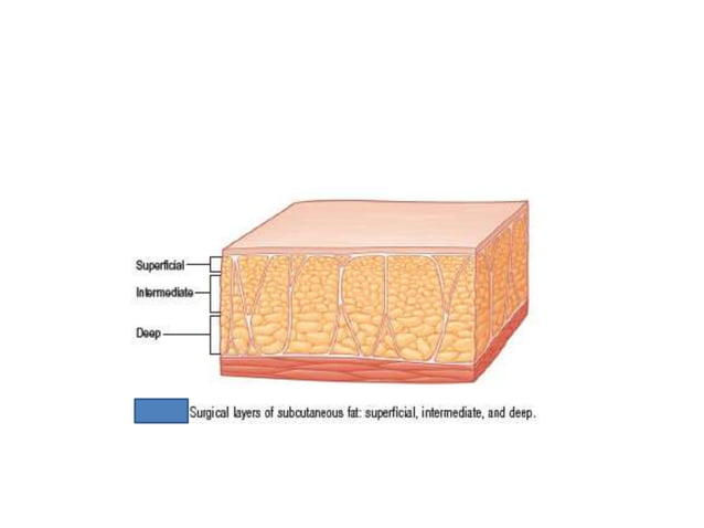 Liposuction- techniques and indications | PPTX