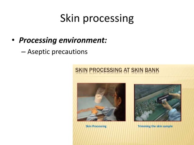 Skin donation, skin banking, skin culture | PPT