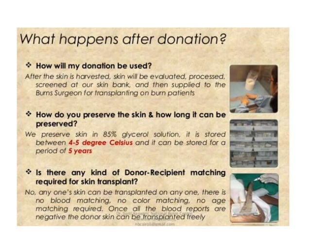 Skin donation, skin banking, skin culture | PPT