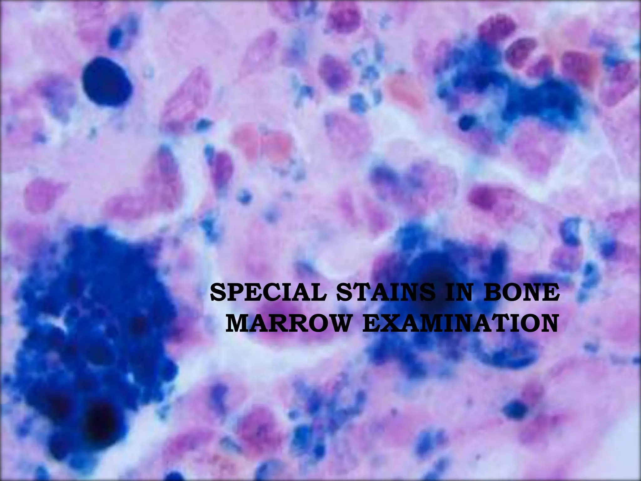 Special stains in Bone marrow examination | PPTX