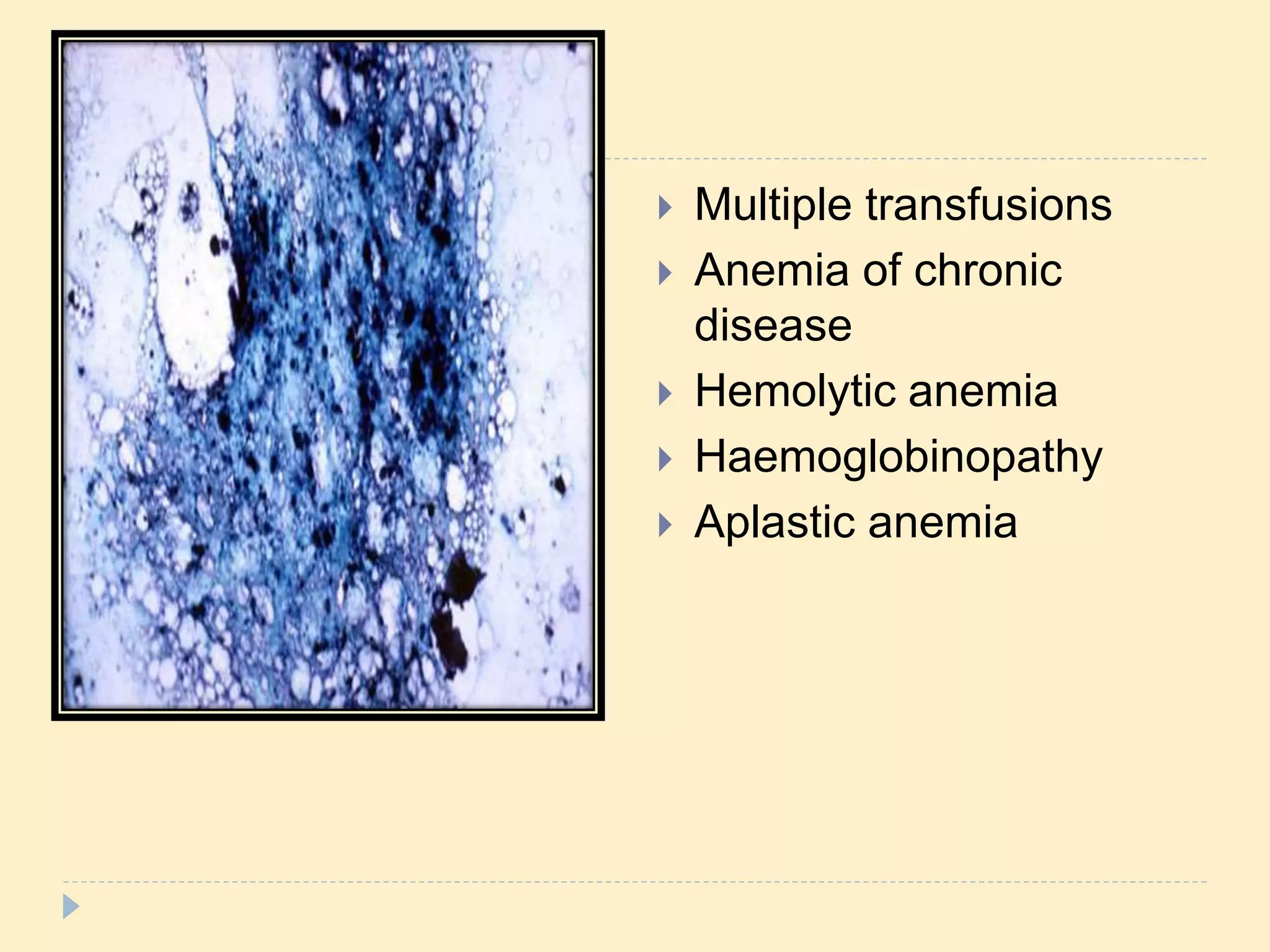 Special stains in Bone marrow examination | PPTX