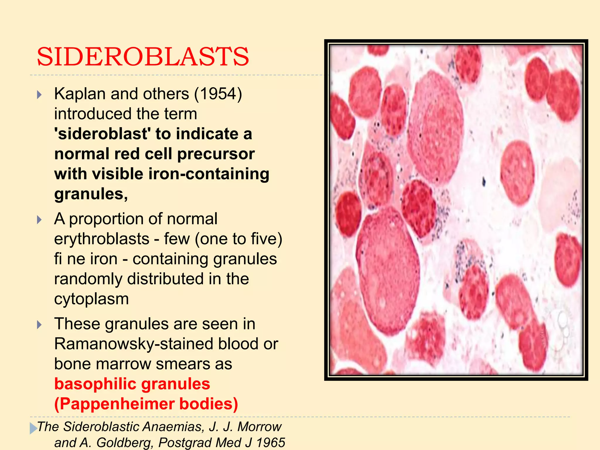 Special stains in Bone marrow examination | PPTX