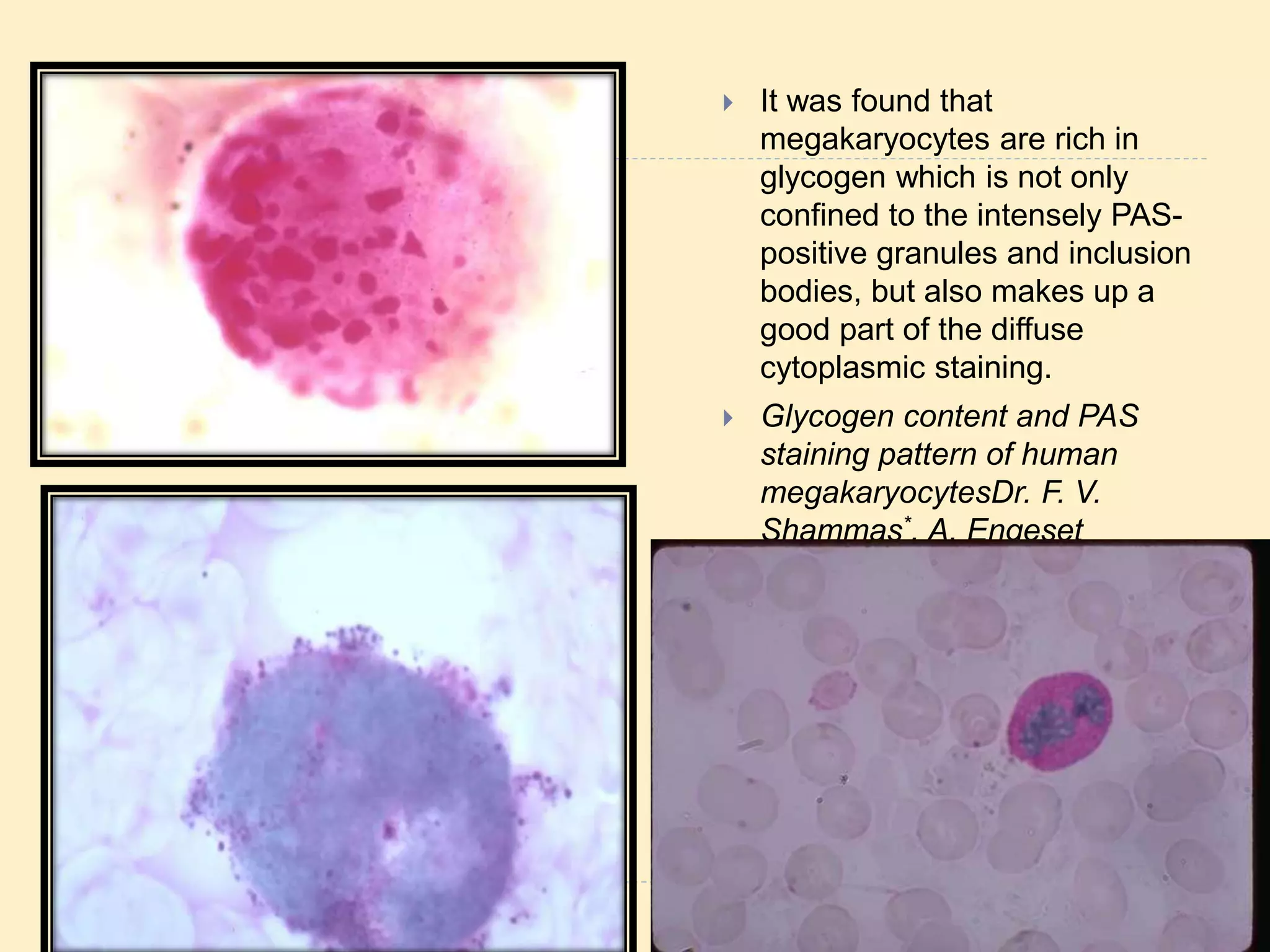Special stains in Bone marrow examination | PPTX