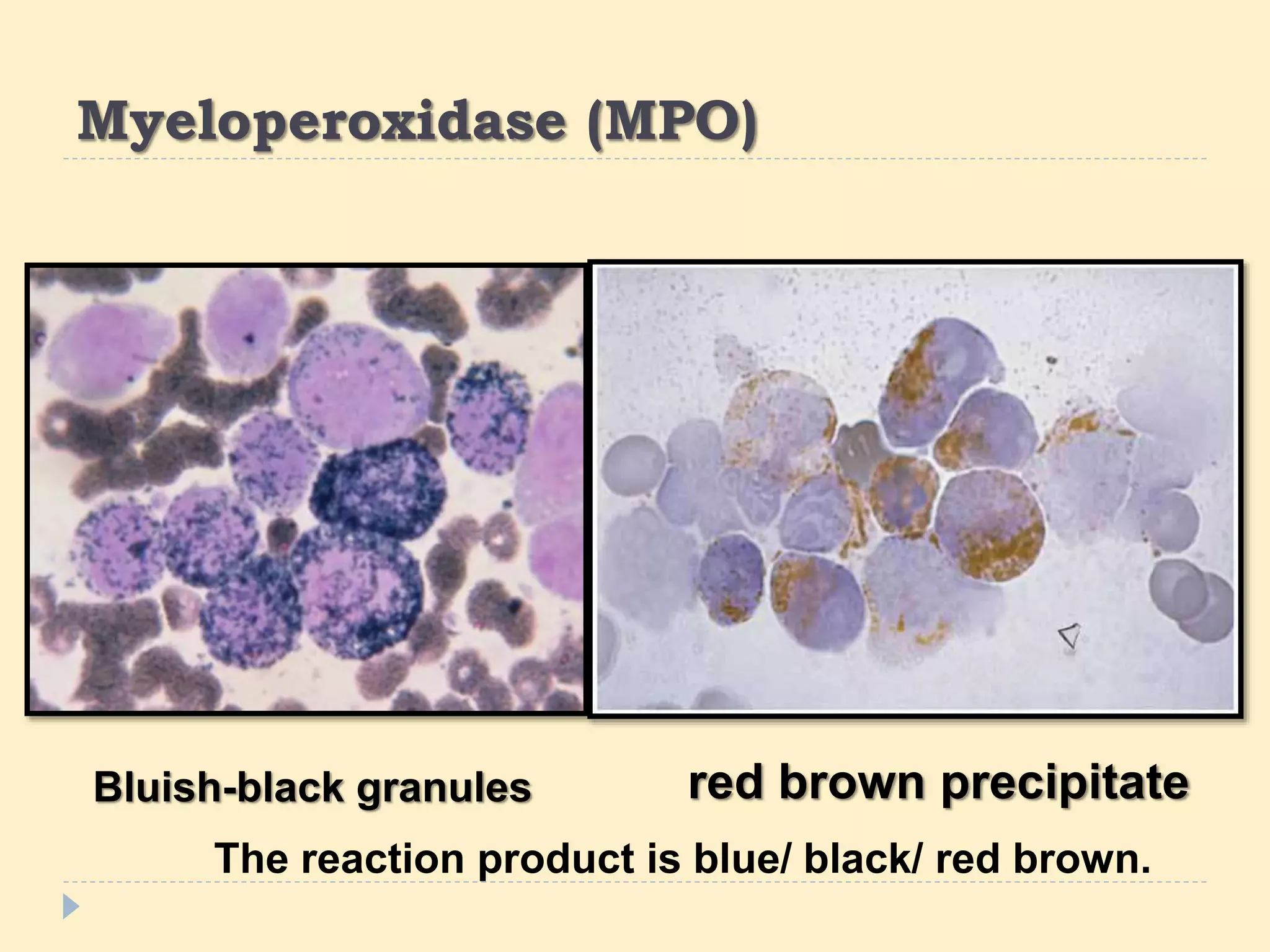 Special stains in Bone marrow examination | PPTX