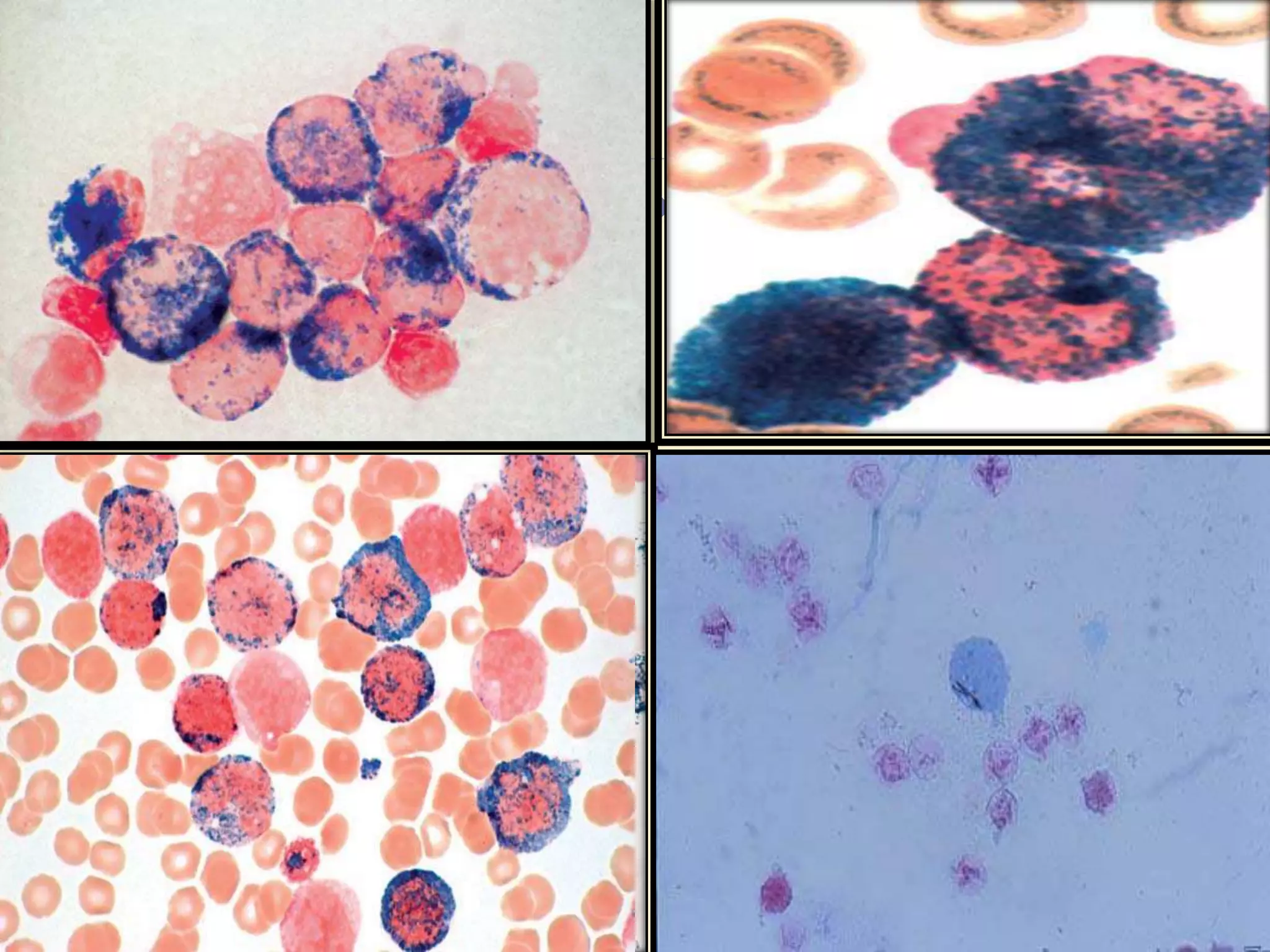 Special stains in Bone marrow examination | PPTX