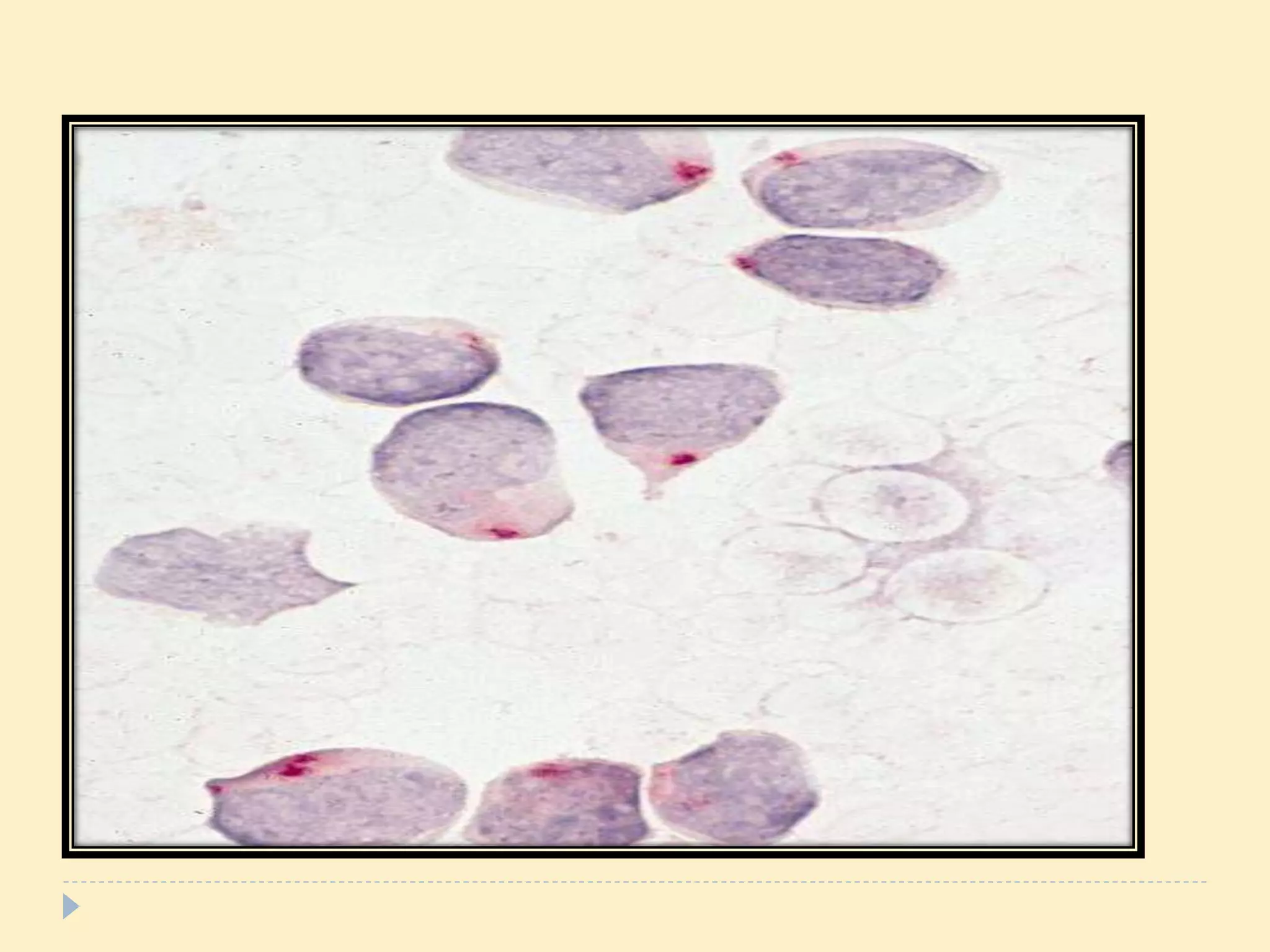 Special stains in Bone marrow examination | PPTX