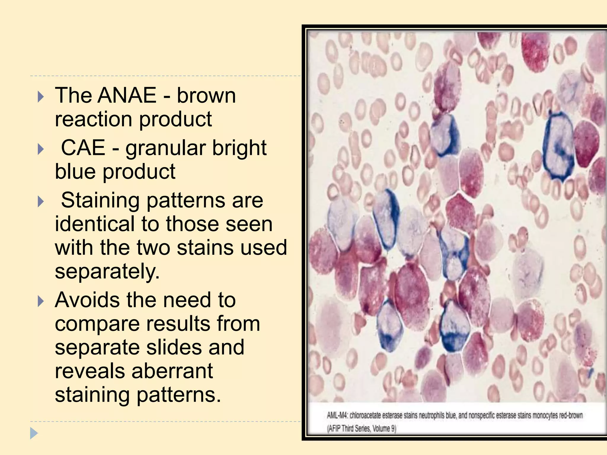 Special stains in Bone marrow examination | PPTX
