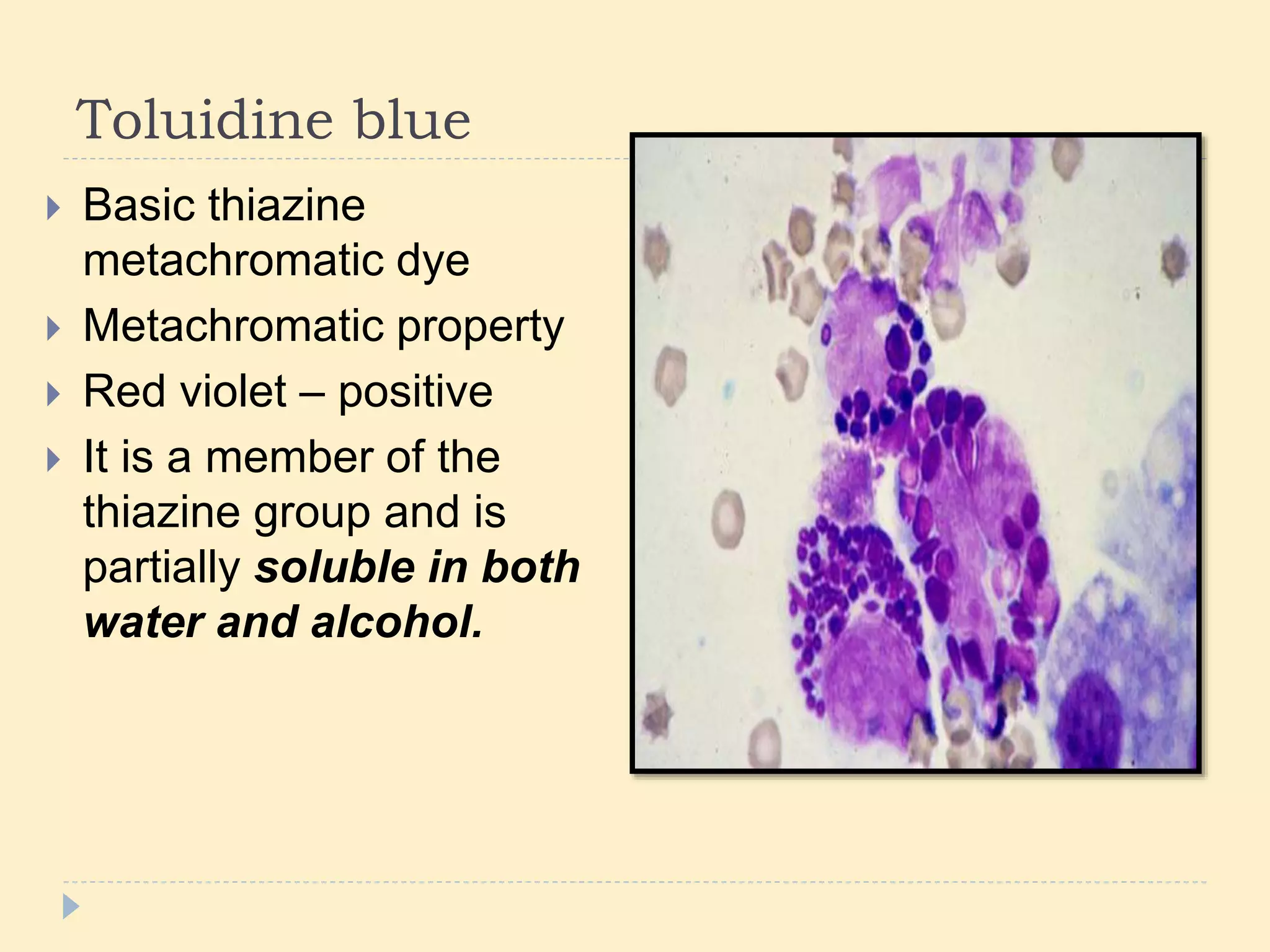 Special stains in Bone marrow examination | PPTX