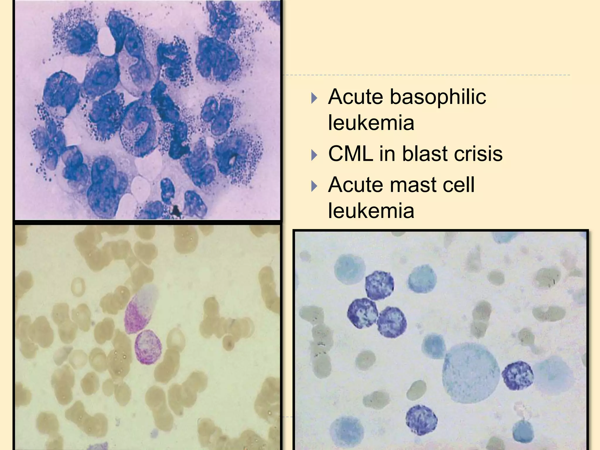 Special stains in Bone marrow examination | PPTX