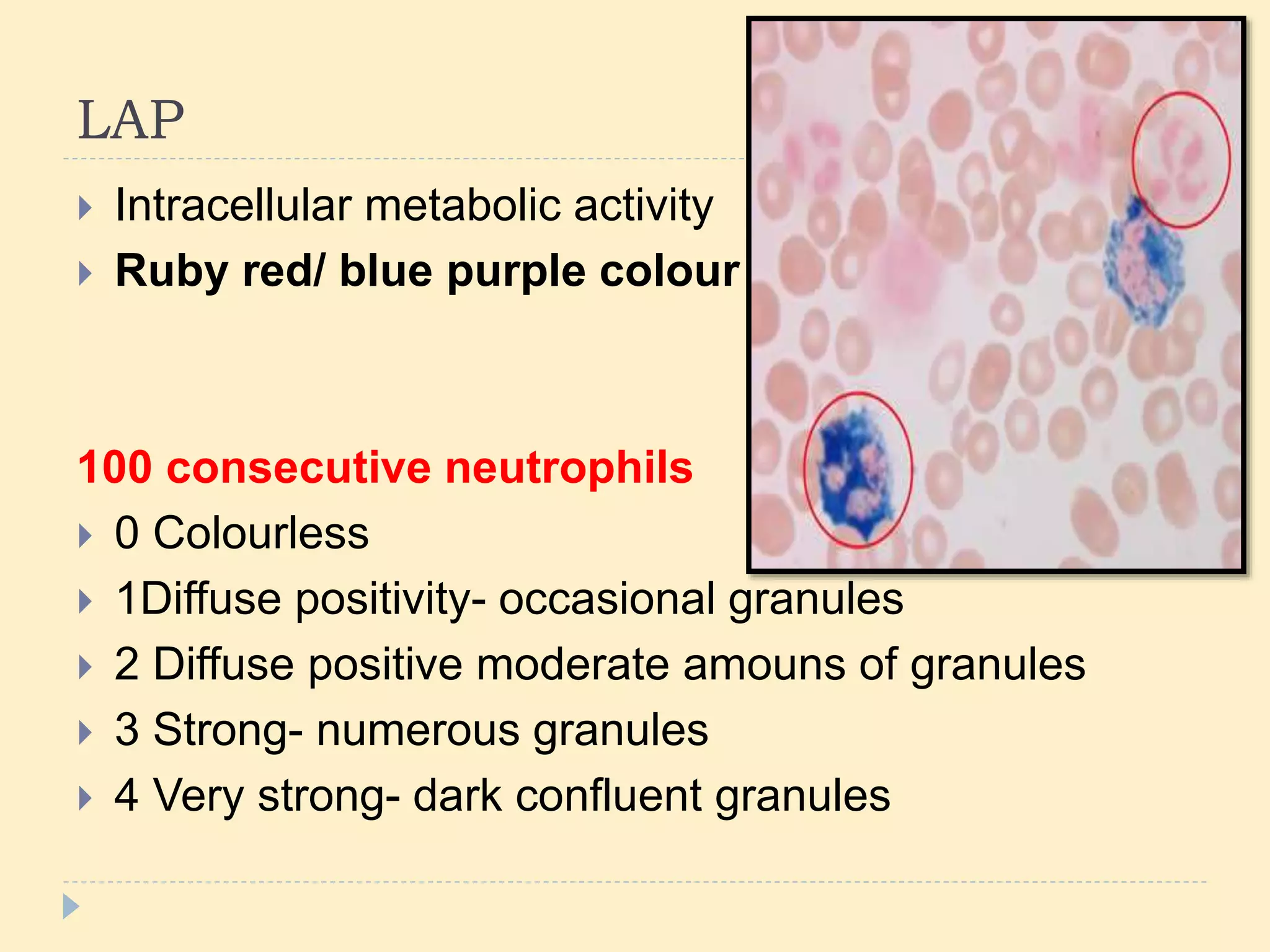 Special stains in Bone marrow examination | PPTX