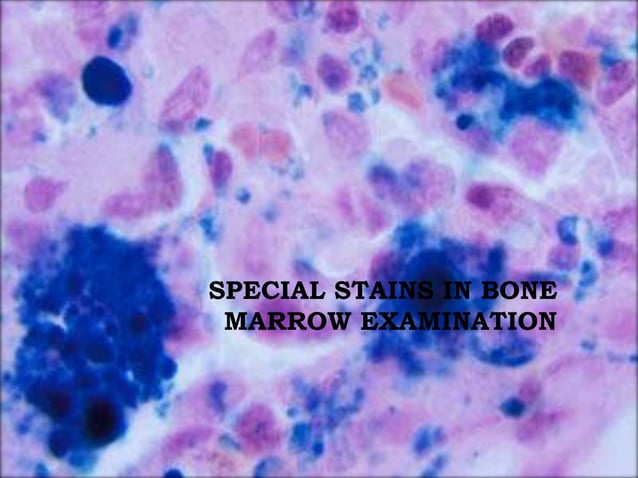 Special stains in Bone marrow examination | PPTX | Blood Disorders ...