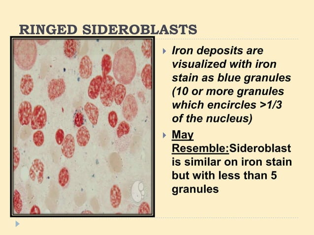 Special stains in Bone marrow examination | PPTX | Blood Disorders ...