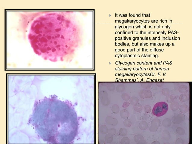 Special stains in Bone marrow examination | PPTX | Blood Disorders | Diseases and Conditions