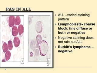 Special stains in Bone marrow examination | PPTX