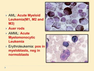 Special stains in Bone marrow examination | PPTX