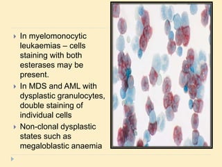Special stains in Bone marrow examination | PPTX
