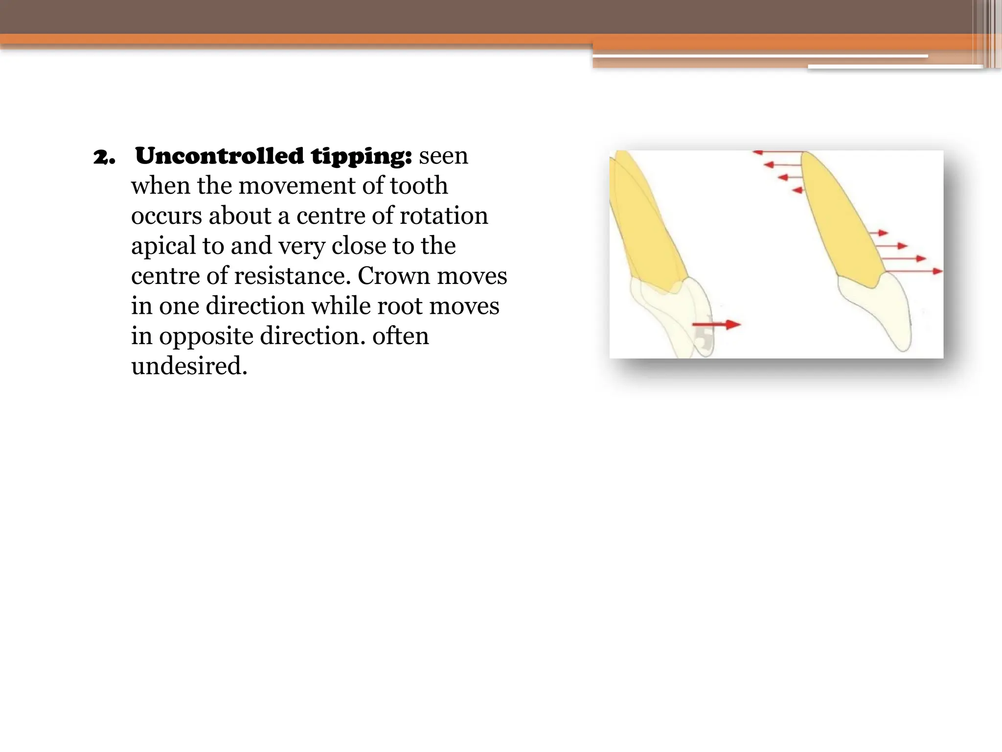 Mechanics of tooth movement, tooth movement in oral cavity | PPTX